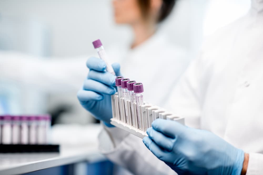 Diagnostics – Fibrinogen Deficiency – Medthority