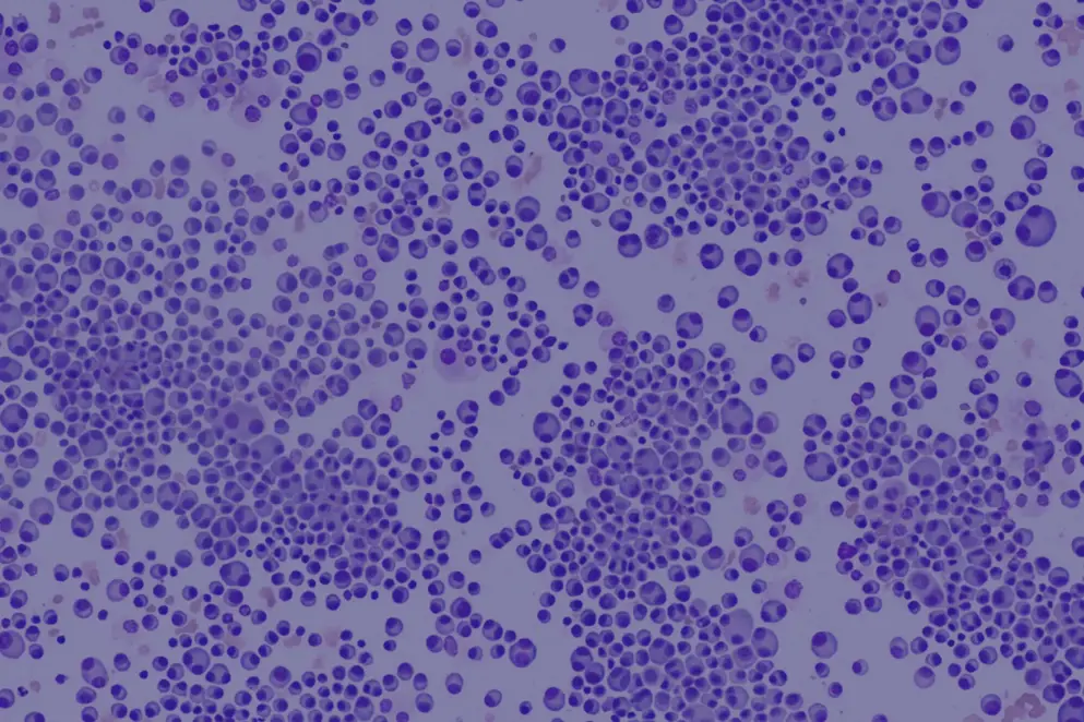 Treatment advances in RRMM – Medthority