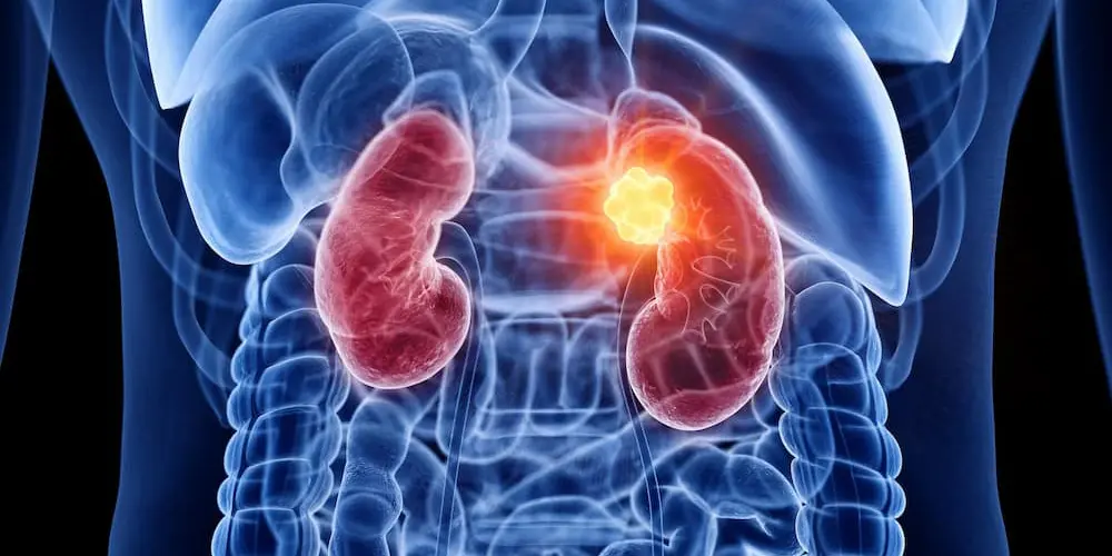 Nephrology Hub - Medthority